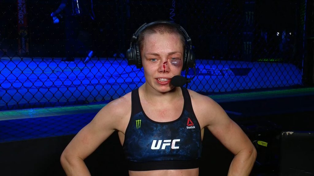 PHOTO Rose Namajunas With MASSIVE Black Eye After UFC 251 Fight