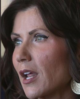 PHOTO Close Up Of Kristi Noem's Facial Injections