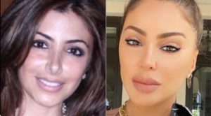 PHOTO Larsa Pippen Before And After Plastic Surgery