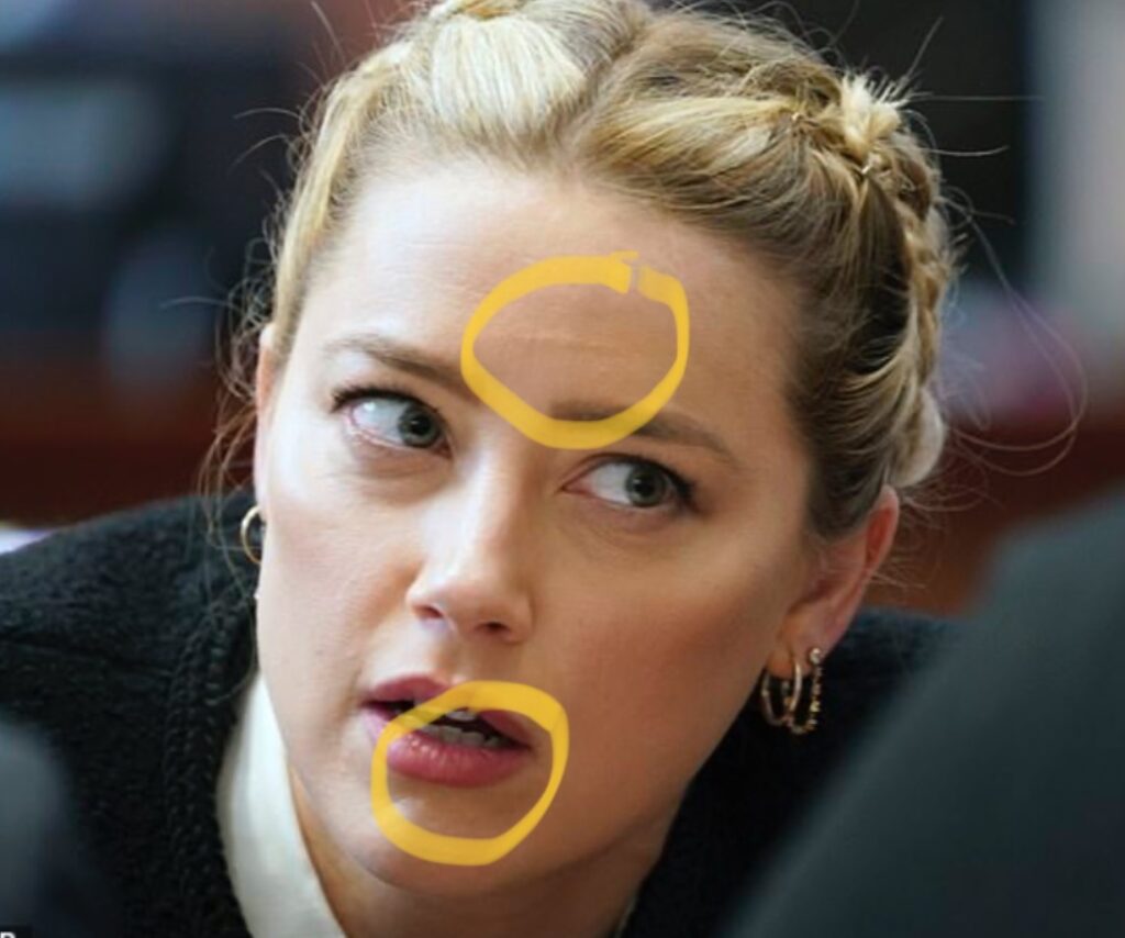 PHOTO Amber Heard Arrived At Court With A Scratch On Her Forehead And ...