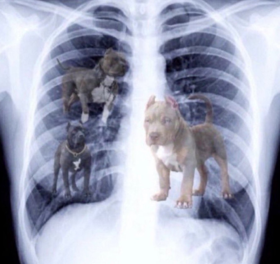 PHOTO X-Rays Confirm That Zach Wilson Hooked Up With His Moms Best ...