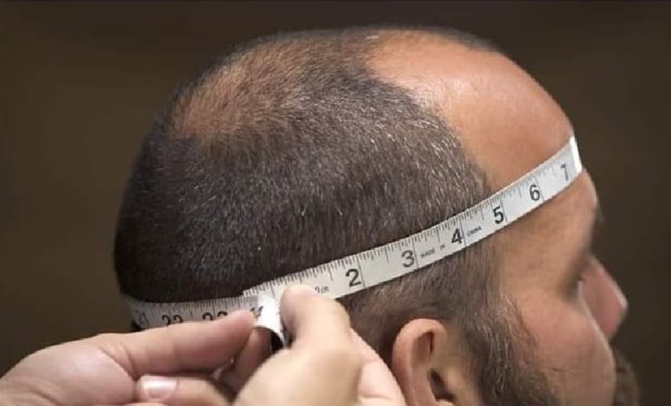 PHOTO Prince Charles Measuring His Head To See If He Can Take Over For ...