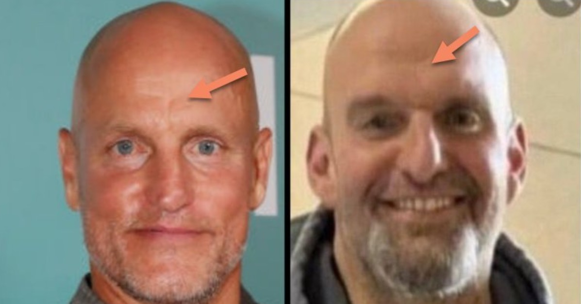 PHOTO The New John Fetterman Has The Same Forehead Indent As The Old ...