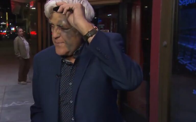 PHOTO Look How Swollen Jay Leno's Eye Is Without The Eye Patch