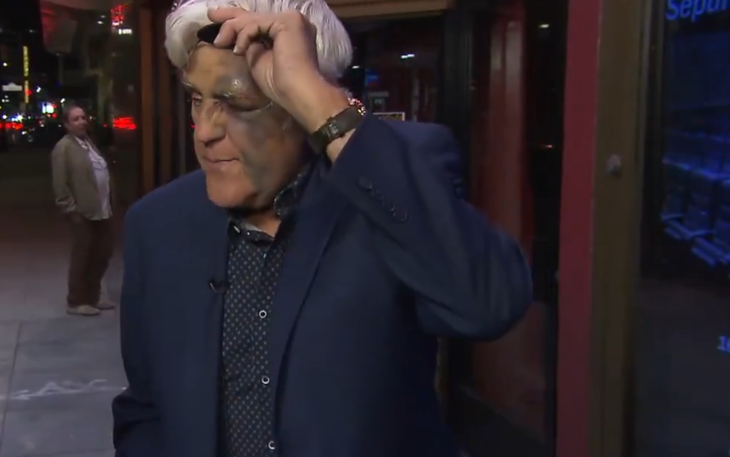 PHOTO Look How Swollen Jay Leno's Eye Is Without The Eye Patch