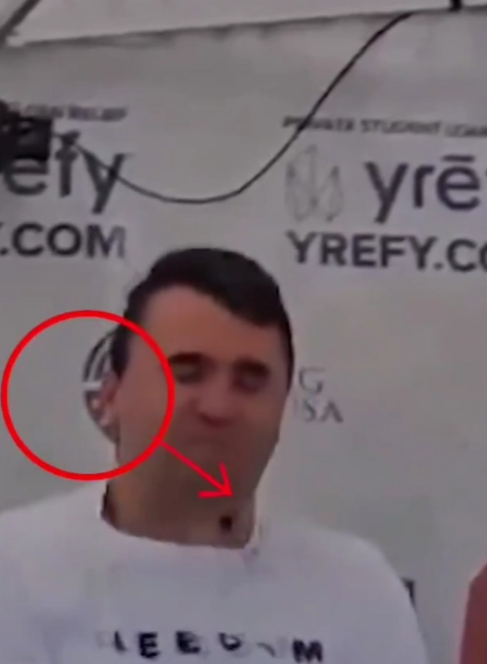 PHOTO The Angle Of The Entry And Exit Wound Seen In The Linked Video ...