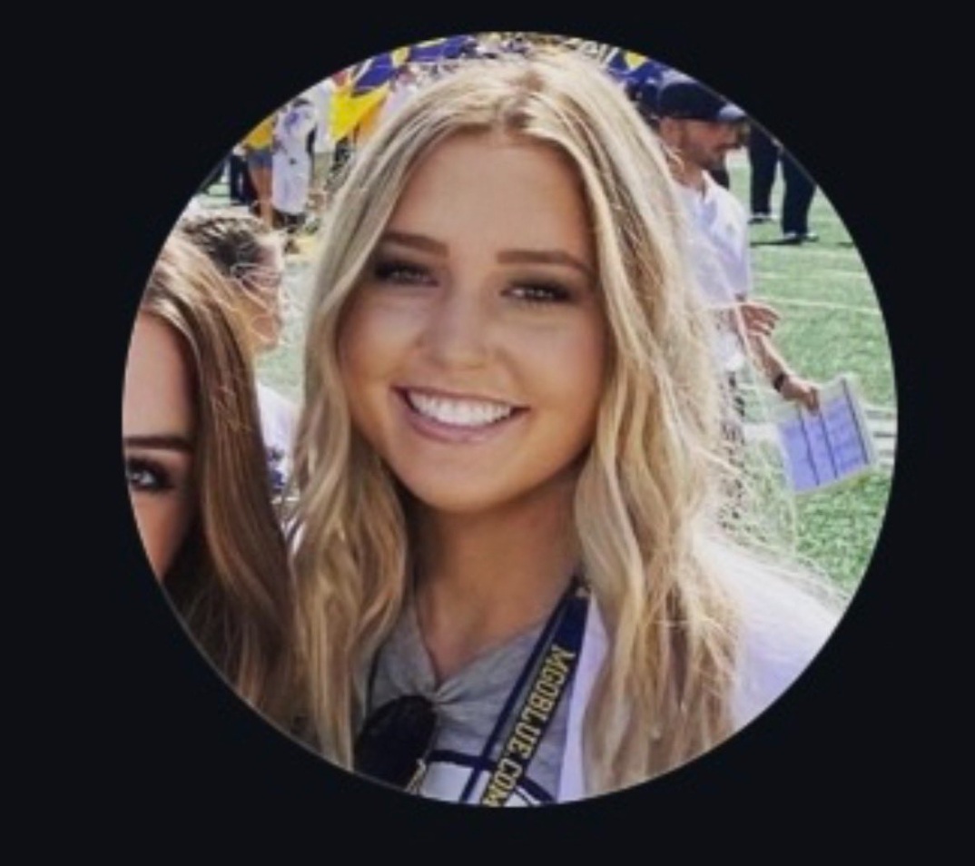 PHOTO Close Up Paige Shivers Looks Like She's Got 100 Acorns In Her Mouth