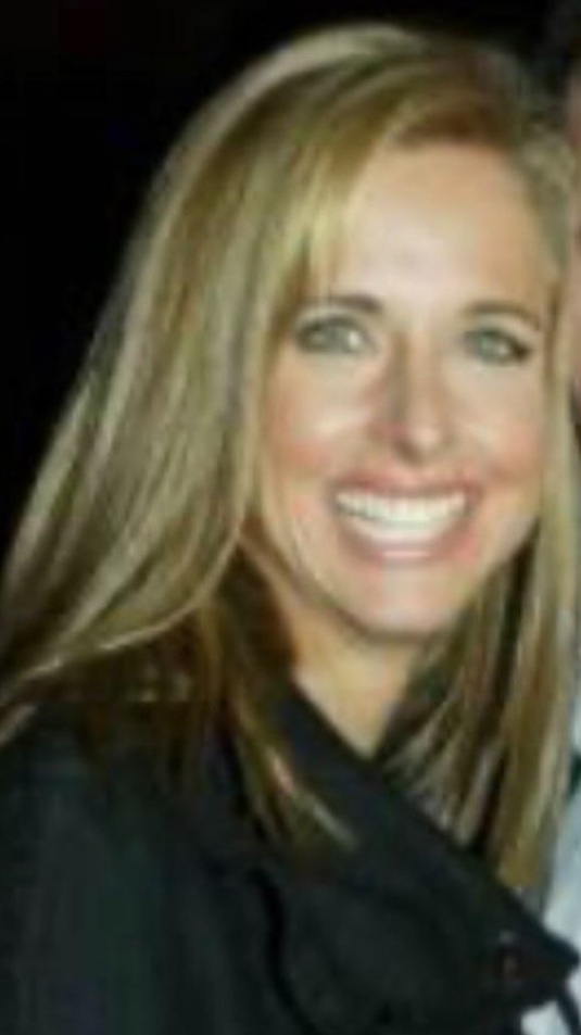 PHOTO Susan Dell Before And After Plastic Surgery