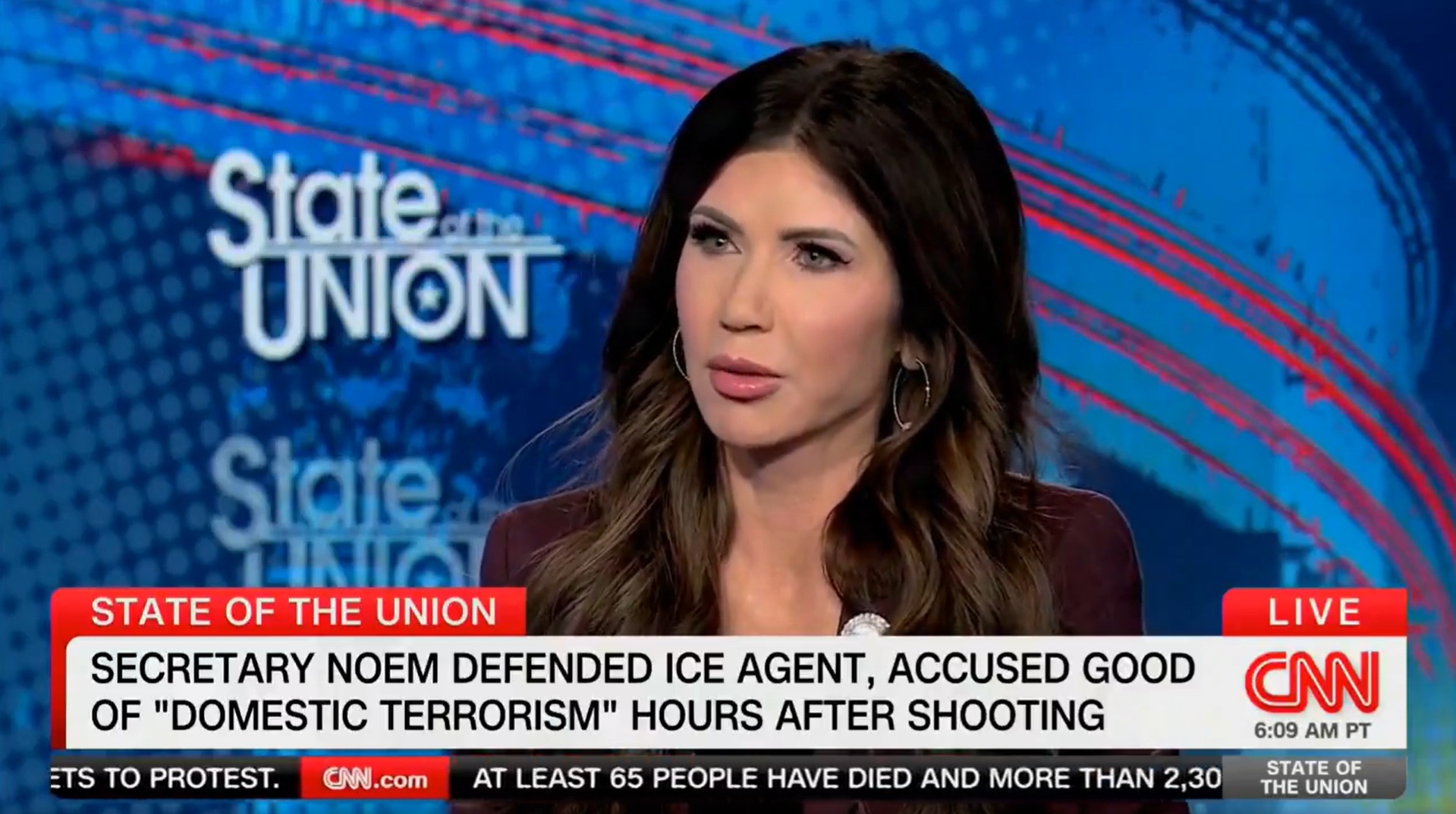 PHOTO Kristi Noem Looks Like She Got More Fresh Plastic Surgery Before ...